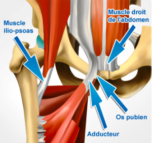 Pubalgie : symptômes, causes et traitement fonctionnel